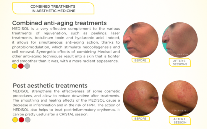 MEDISOL® - High Power LED using Photobiomodulation